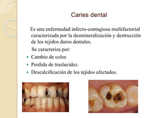 Prevencion de la caries dental | PPTX