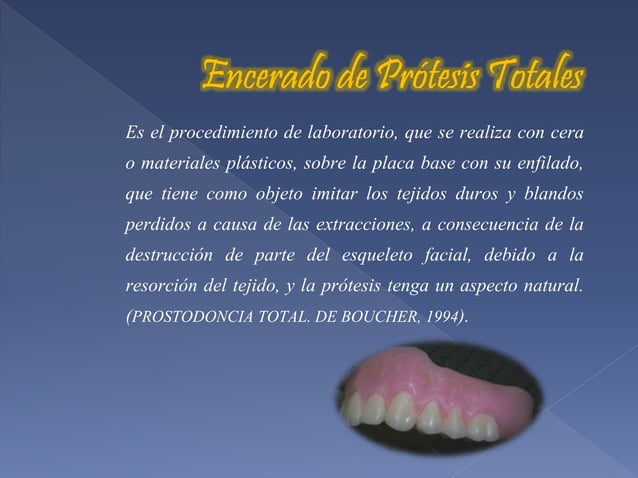 Presentacion de procedimiento de encerado, enmuflado, acrilizado en ...