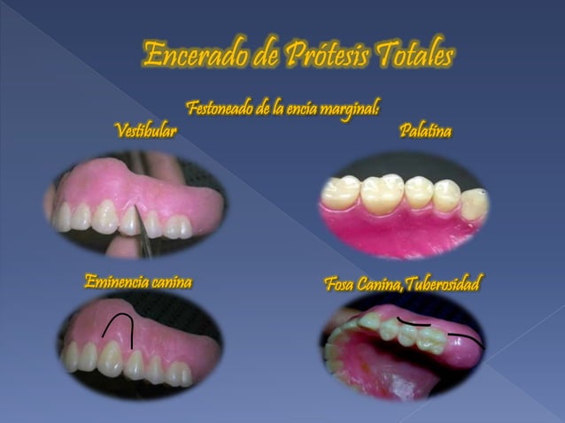 Presentacion de procedimiento de encerado, enmuflado, acrilizado en ...