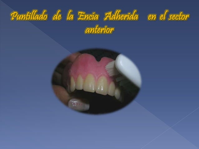 Presentacion de procedimiento de encerado, enmuflado, acrilizado en ...
