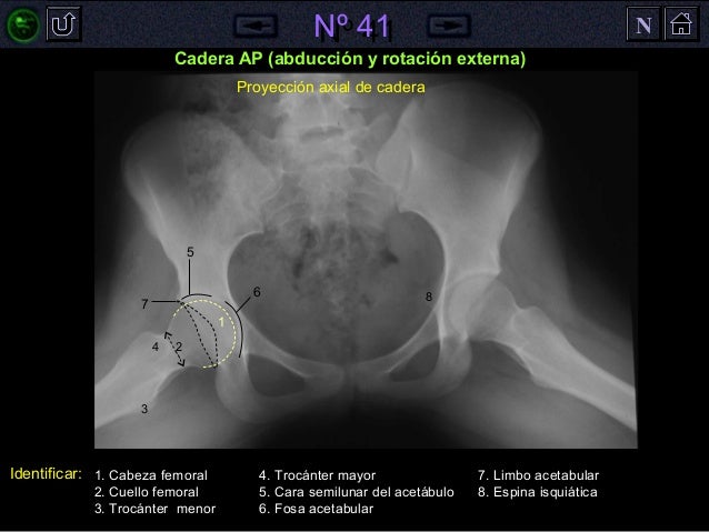 Presentacion de radiologia_normal