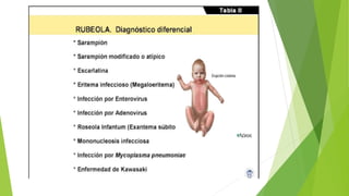 Presentación de la enfermedad de la Rubeola Y Síndrome de Rubeola ...