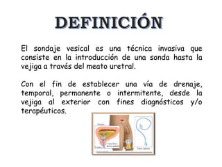 PRESENTACION DE SONDAJE VESICAL.pptx