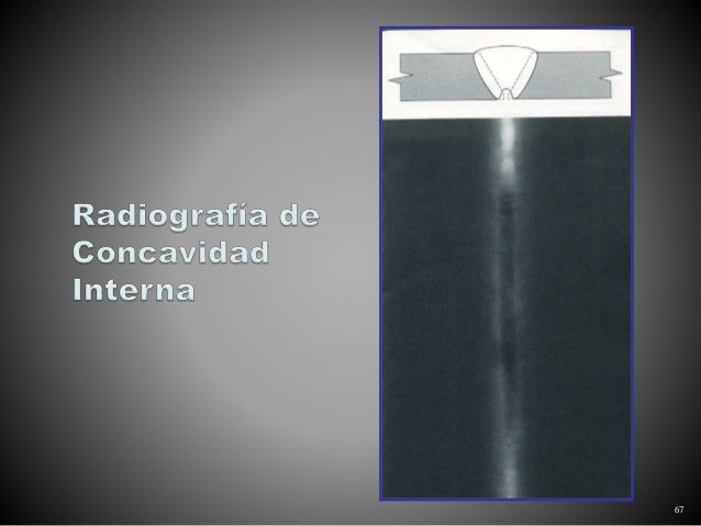 Discontinuidades y Defectos en Soldadura