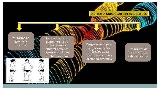 Presentacion distrofia muscular