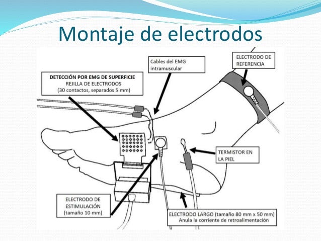 Presentacion electromiografía
