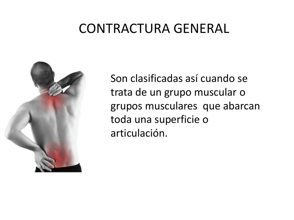 Contracturas Que Es