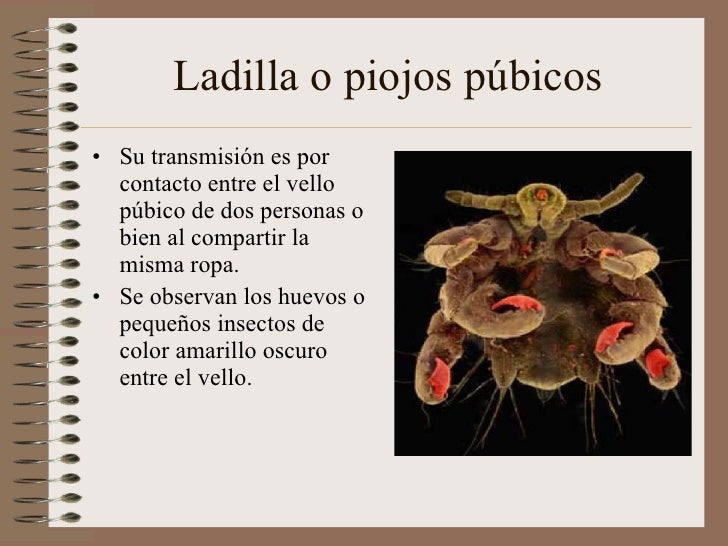 enfermedades de transmisión sexual