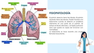 lobectomia | PDF