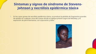 Síndrome de Stevens - Johnson y Necrólisis epidérmica tóxica. | PPTX
