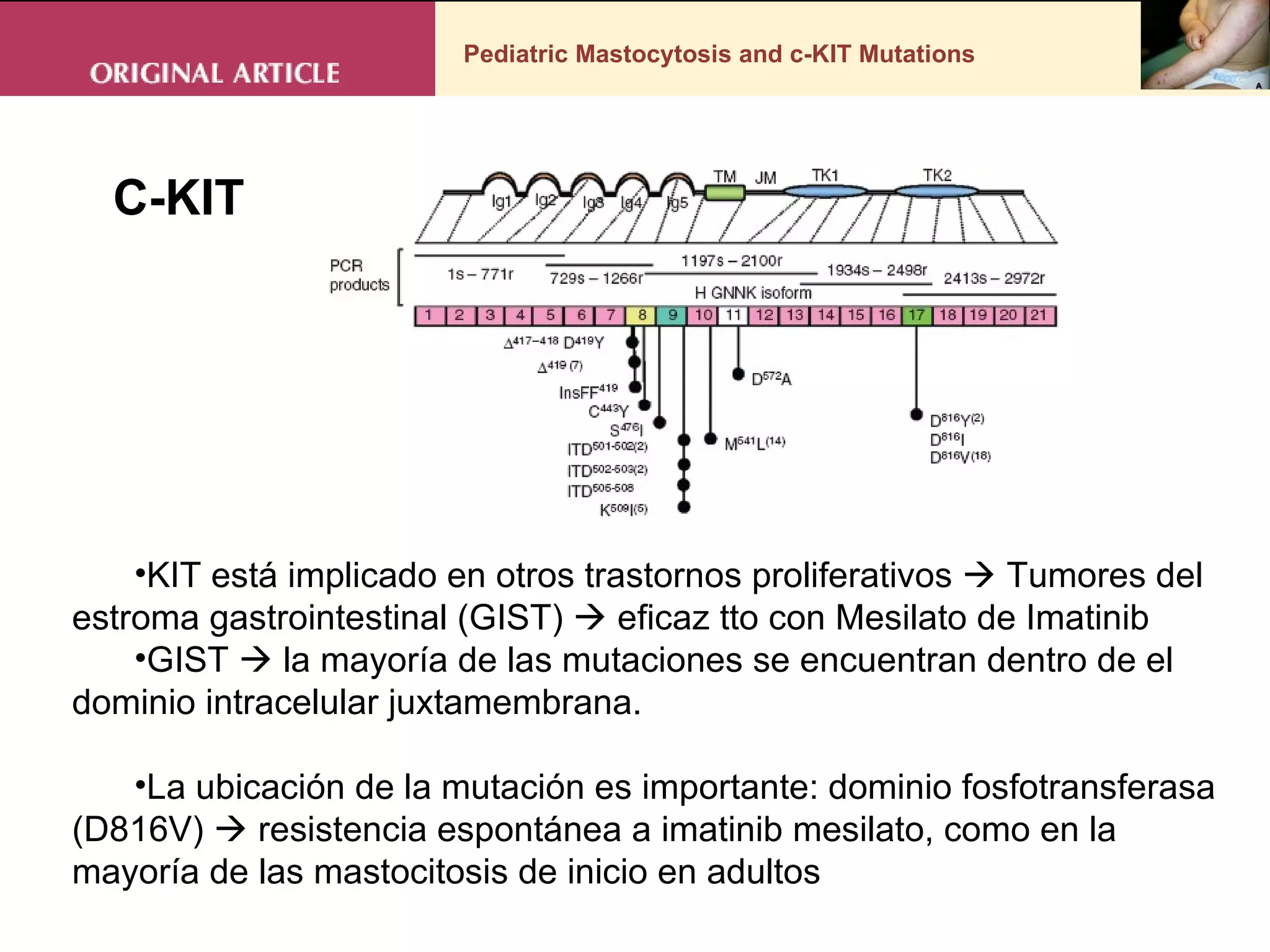 Presentacion ficha Ingrid Rivera mastocitosis | PPT