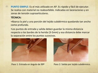 (2012-10-25) Principios basicos de la sutura manual(ppt) | PPT