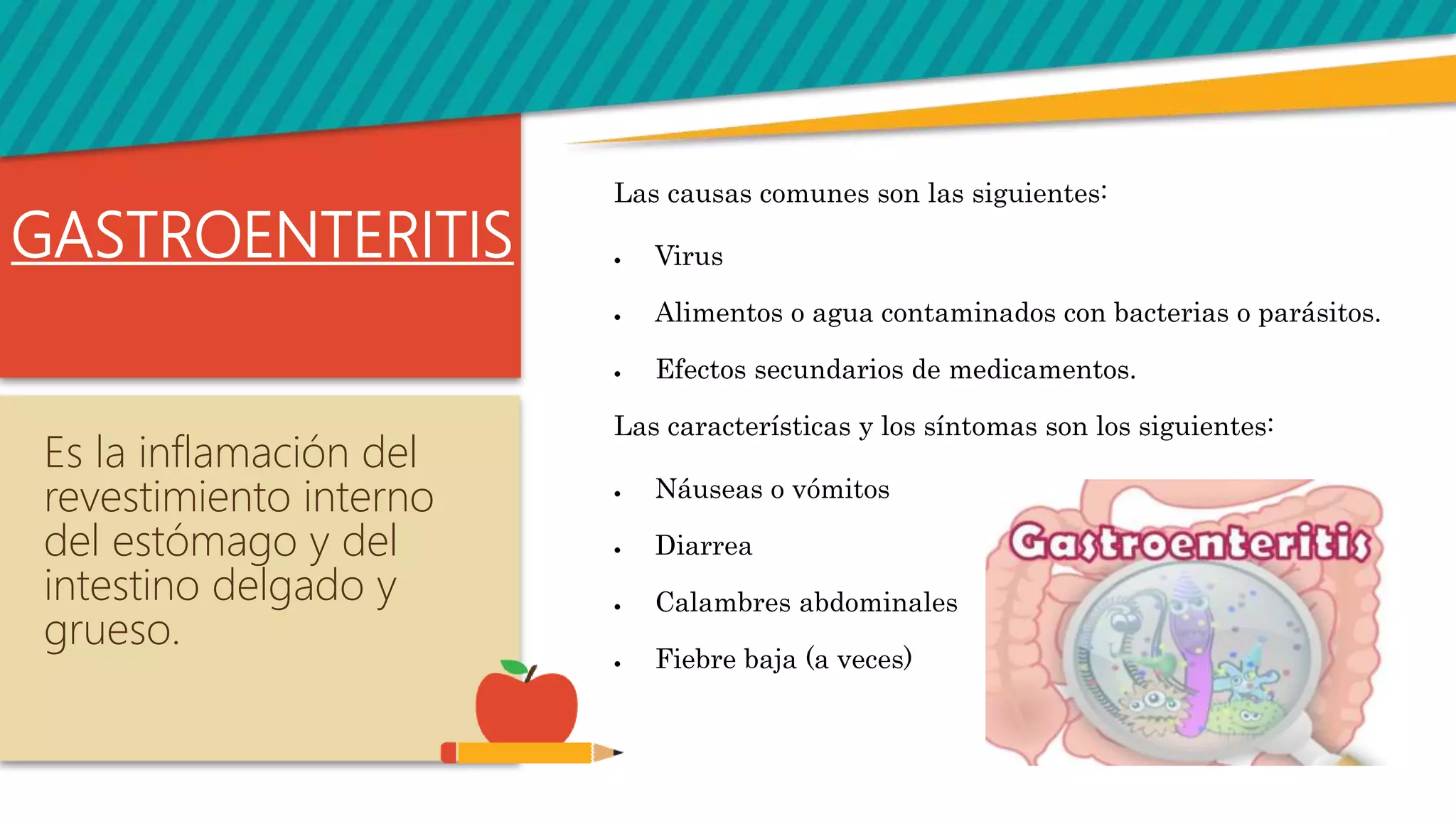 Presentacion gastritis y gastroenteritis | PPTX