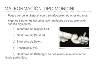 Presentacion hipoacusia powerpoint | PPTX