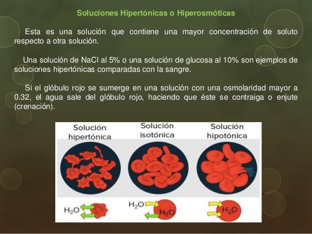 Soluciones Hipertonicas
