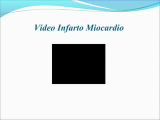 Infarto Miocardio | PPT