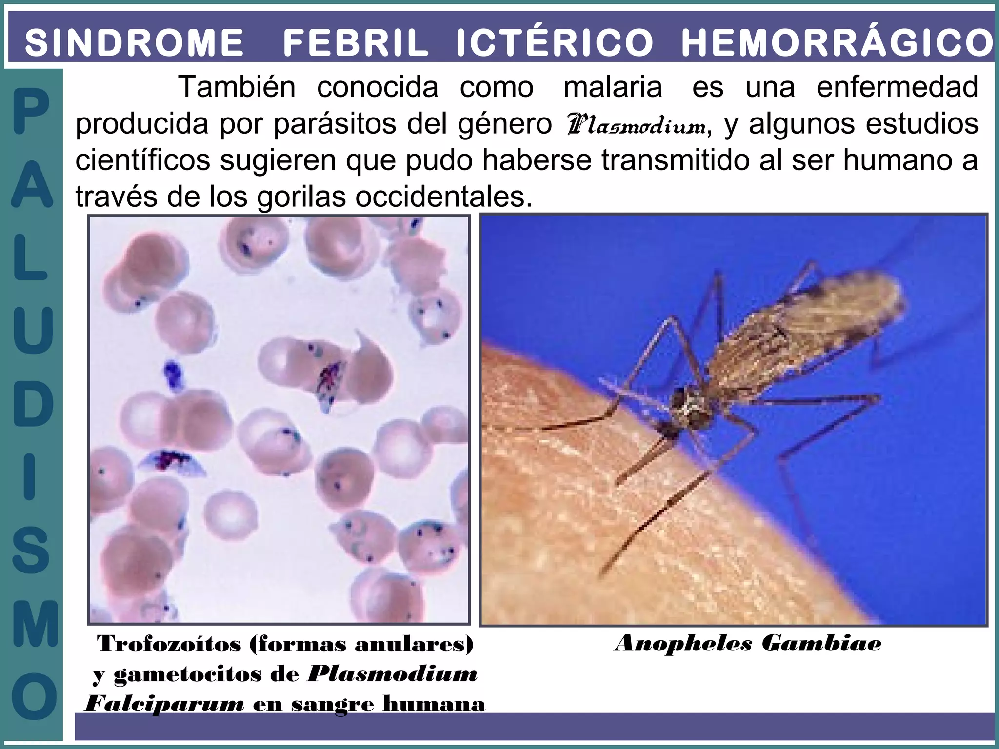 SÍNDROME FEBRIL ICTERO HEMORRAGICO | PPT