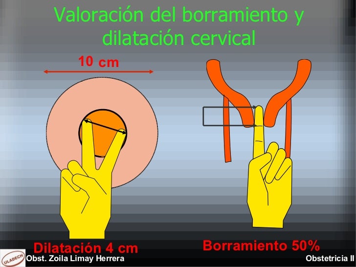 Modificaciones Cervicales Y Descenso De La Presentación