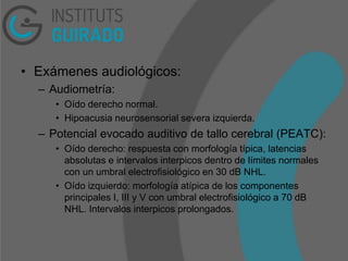 Hipoacusia Congénita Progresiva Malformación Coclear partición Tipo II ...