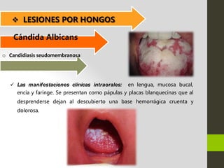 presentacionodp-150528035245-lva1-app6891.pptx
