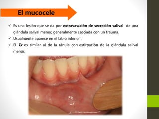 Lesiones estomatológicas en niños y adolescentes | PPTX