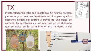 Enfermedades intestinales/croh y colitis ulcerosa .pptx.pptx