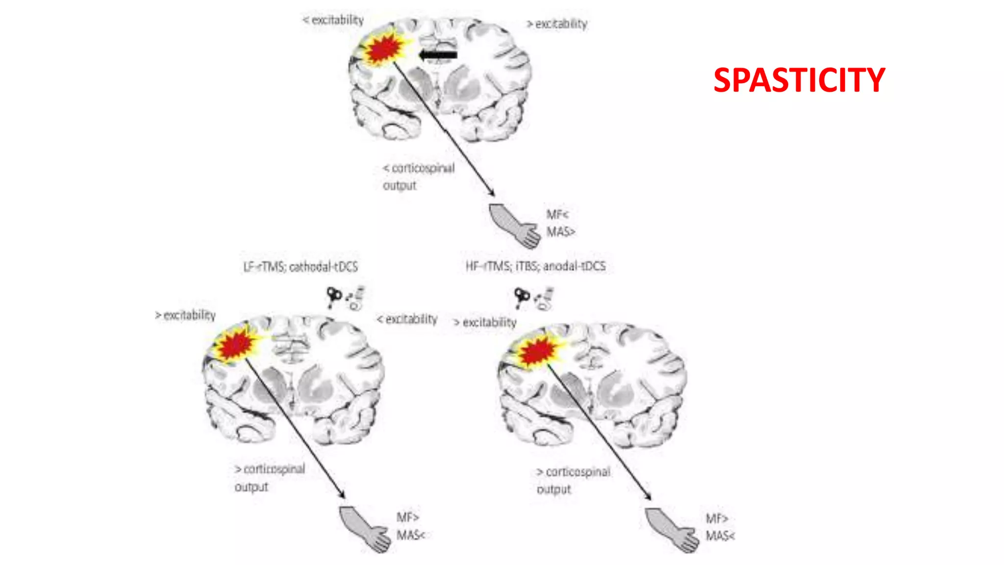 Transcranial Magnetic Stimulation versus Transcranial Direct Current ...