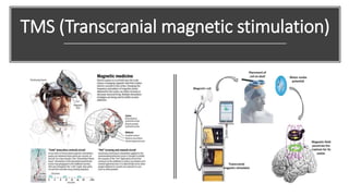 Transcranial Magnetic Stimulation versus Transcranial Direct Current ...