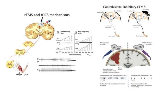 Transcranial Magnetic Stimulation versus Transcranial Direct Current ...