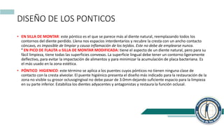 Presentacion ponticos | PPTX