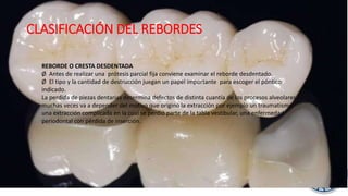 Presentacion ponticos | PPTX