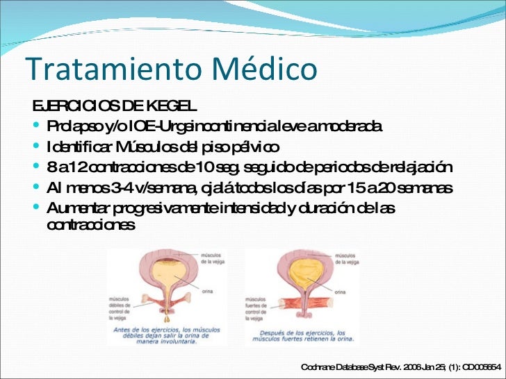 Prolapso Y Sexualidad at Herman Stpierre blog
