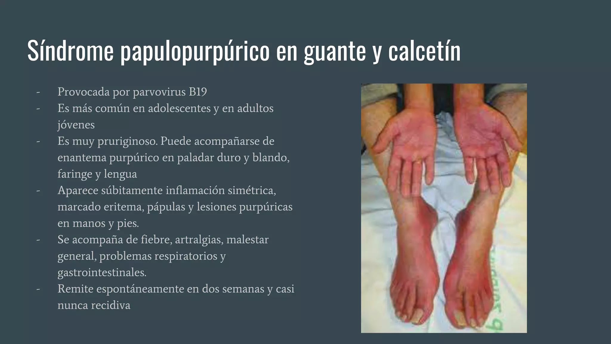 Enfermedades exantemáticas