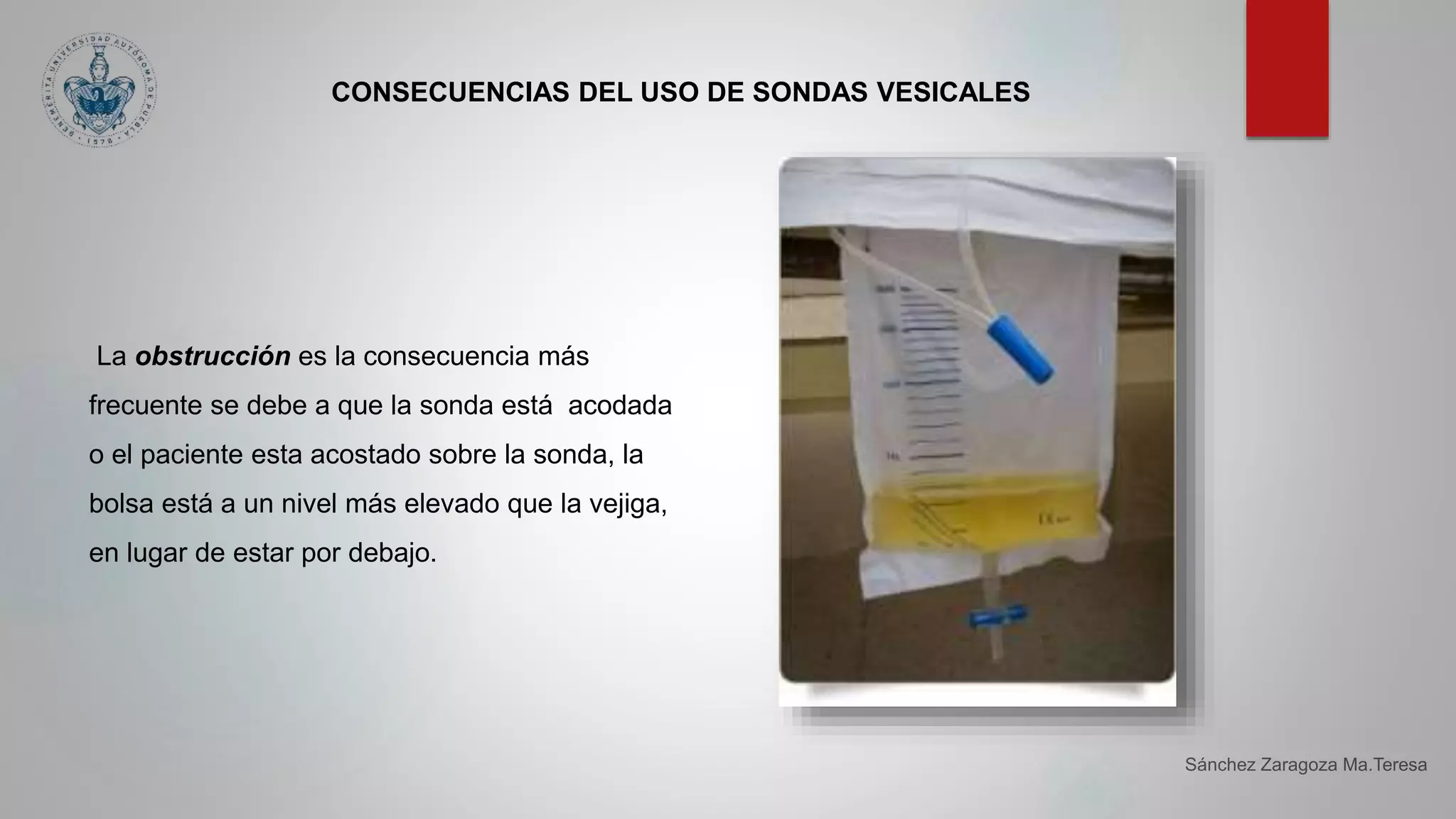 Sondaje Vesical | PPTX