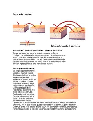 Presentacion suturas | DOCX