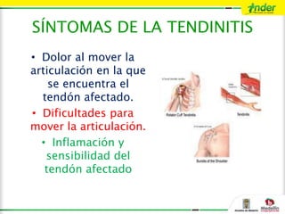 Presentacion tendinitis | PPTX