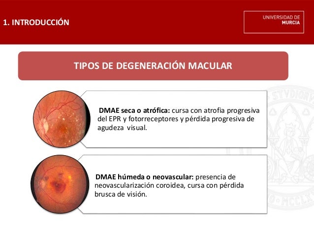 Perspectivas futuras en el tratamiento de la DMAE