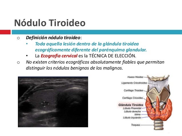 Nódulo tiroideo clasificación Ti-rad