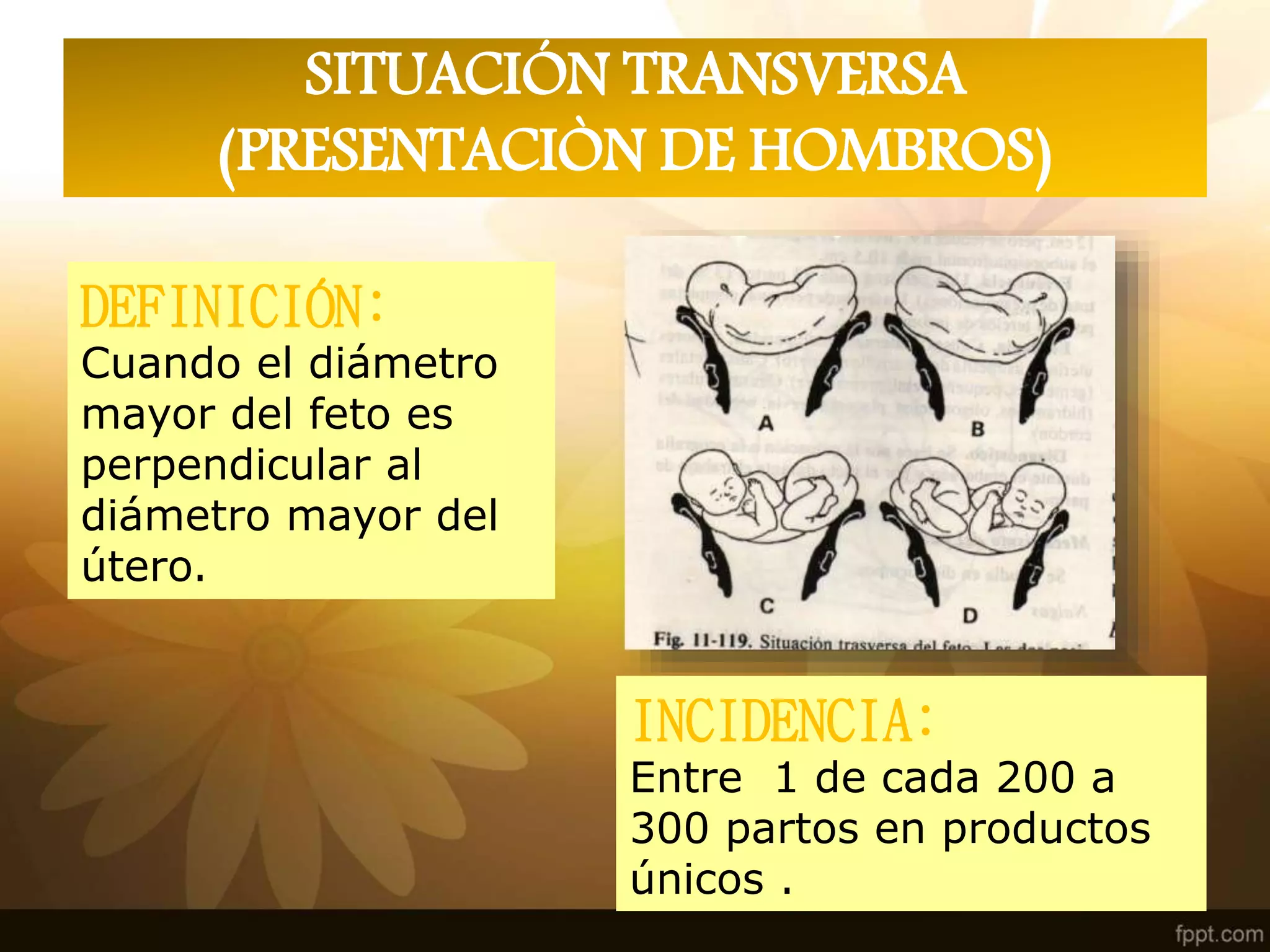 Presentacion transversa | PPT