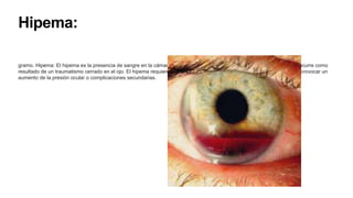 presentacion trauma ojo (1).pptx