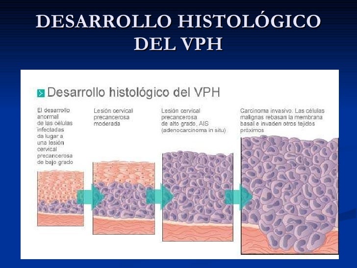 Presentacion vph