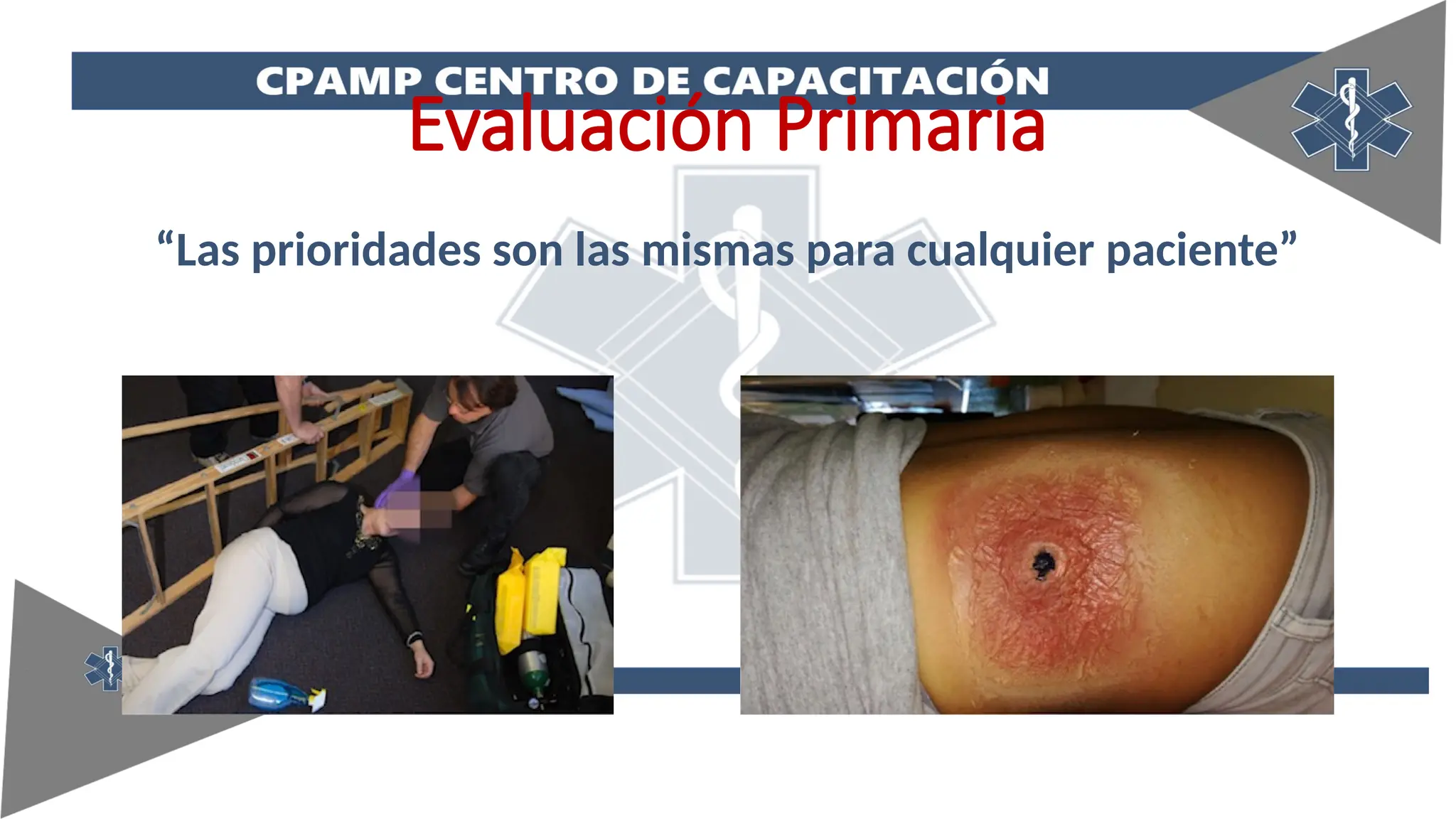 Protocolo de Atención XABCDE del Trauma. | PPTX
