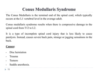 Presentaion - SCI Syndrome.pptx