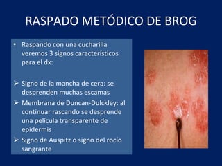 (2019-01-16) LA IMPORTANCIA DEL PAPEL DE ENFERMERÍA EN PACIENTES CON ...