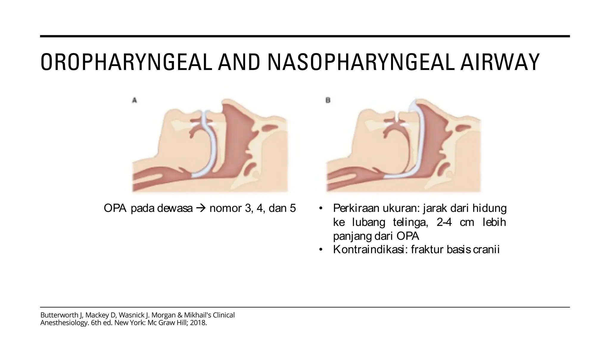Presentasi Airway Management_Residen Semester 1.pdf