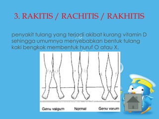 Gangguan pada tulang dan sendi | PPTX