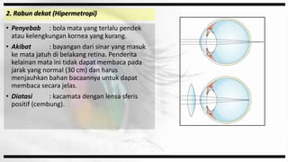 Biologi : ALAT INDERA MANUSIA (MATA) | PPTX