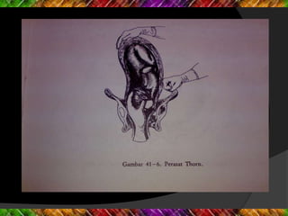 Presentasi dahi | PPTX