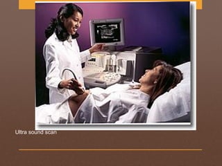 PRESENTASI DAN BARINGAN ABNORMAL - KEADAAN BERKAITAN DENGAN KEHAMILAN | PPT