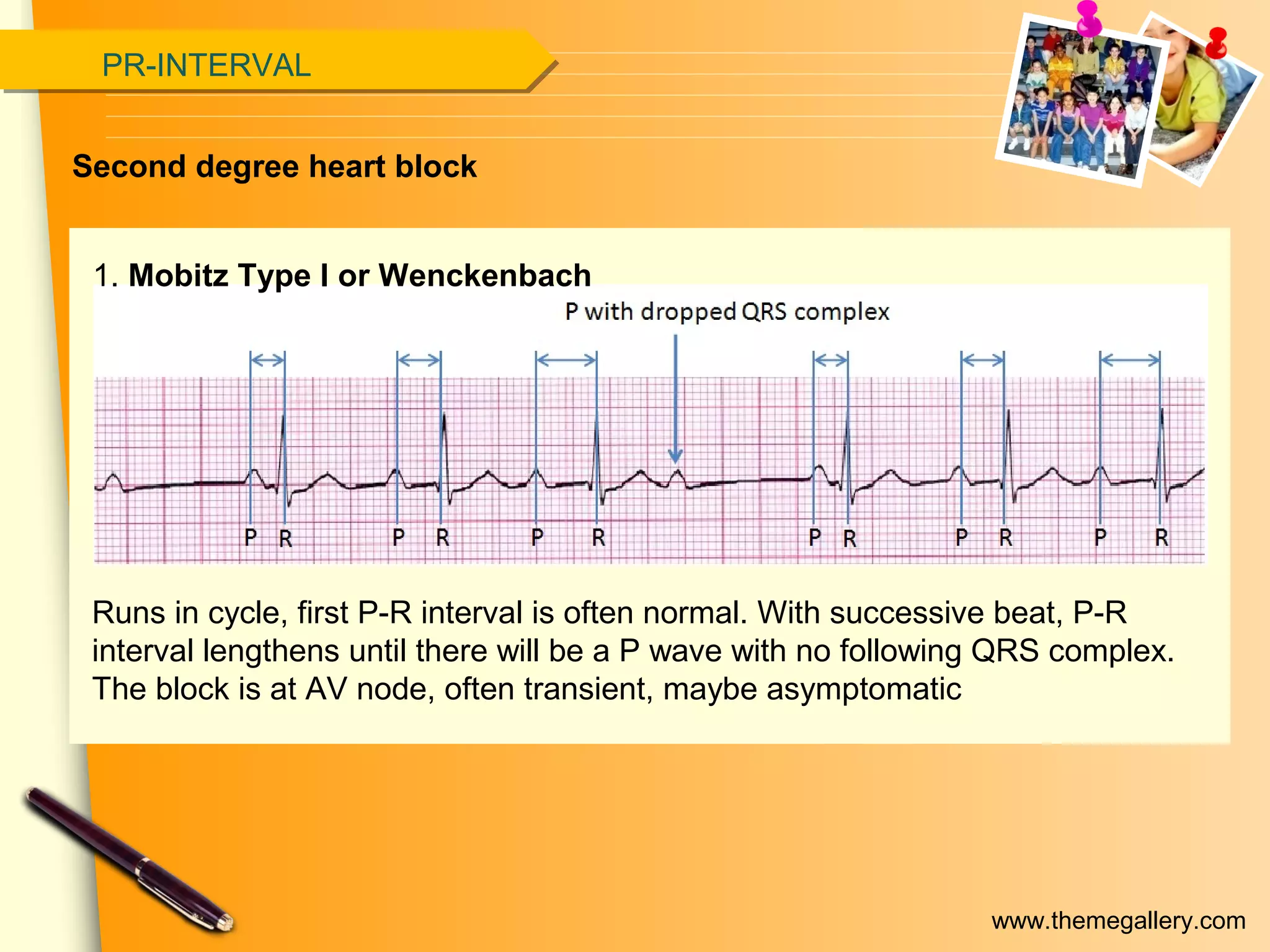 Presentasi ekg rs agung | PPT